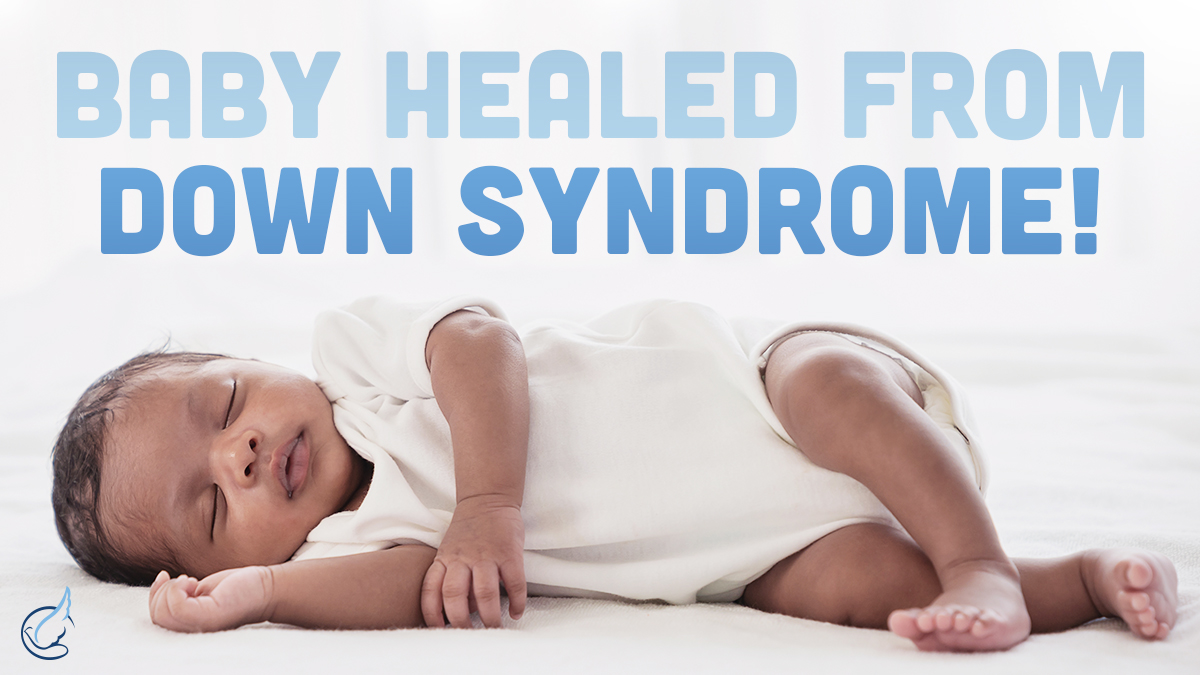 Down Syndrome Baby Model